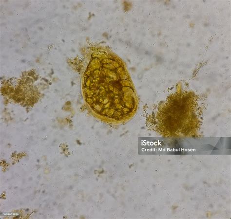 Vegetable Cell Of Stool Analysis Under 40x Light Microscope Fecul