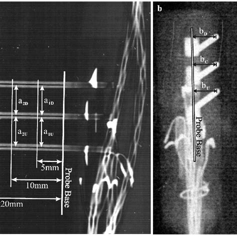 X Ray Radiographs Showing A Heat Ratio Sensor Inserted Into The Xylem