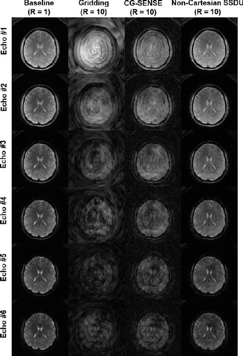Figure 2 From Non Cartesian Self Supervised Physics Driven Deep Learning Reconstruction For