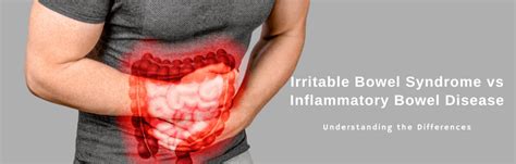 Irritable Bowel Syndrome Vs Inflammatory Bowel Disease