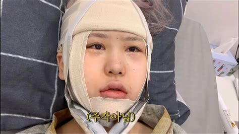 안면윤곽수술 이후 드디어 근황 공개한 유명 유튜버 사진 8장