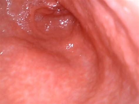 My Girlfriends Squirming Pylorus