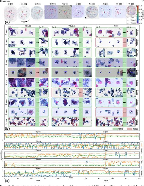 Figure 7 From An Efficient Cervicalwhole Slide Image Analysis Framework