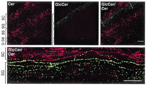 Ceramide And Glucosylceramide Are Complementary Localized In Human Download Scientific Diagram