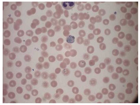 Classification Of Malaria Using Object Detection Models