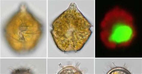 마약성 진통제 대체할 신종 해양식물플랑크톤 발견