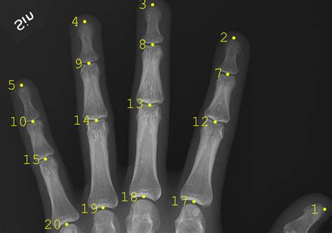 X Ray Analysis Ingedata