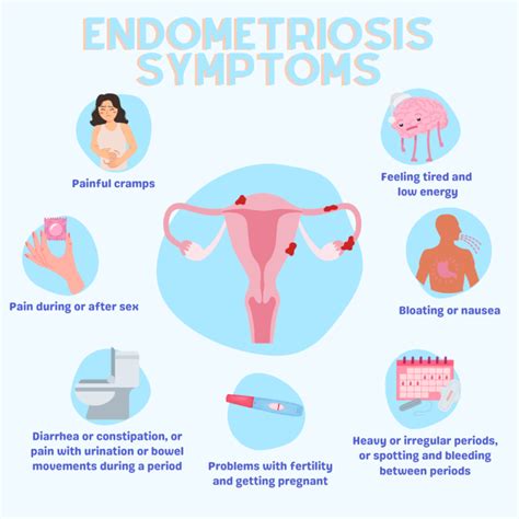 Endometriosis Teen Health Source