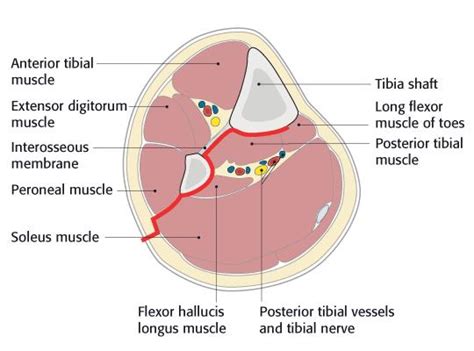 Tibia Posterolateral Approach Approaches Orthobullets