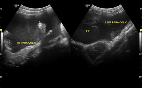 Rsna Abstract Rradiology
