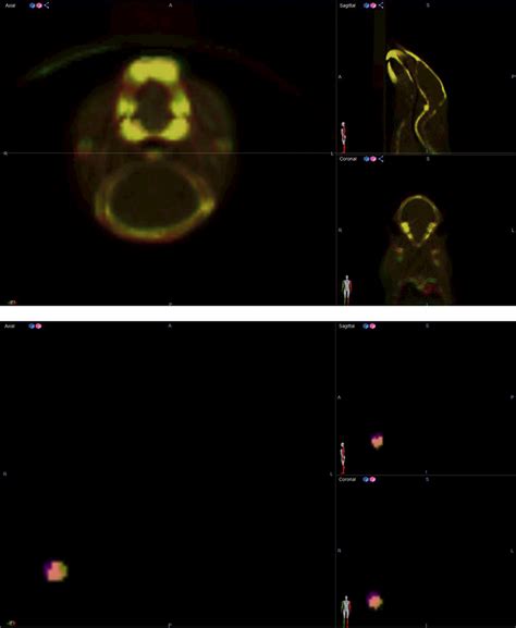 Velocity Based Adaptive Registration And Fusion For Fractionated