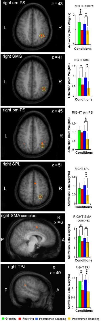 Activation For Pantomimed Grasping Vs Pantomimed Reaching Within The Download Scientific