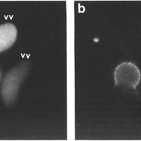 Differential Staining Of The Nuclear Envelopes Of Regrown Sperm Nuclei Download Scientific