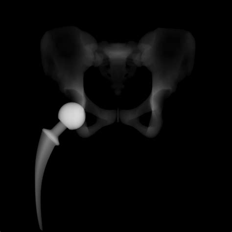 Github Jstnmchlxraysimulator A Simple X Ray Simulator Written In Matlab