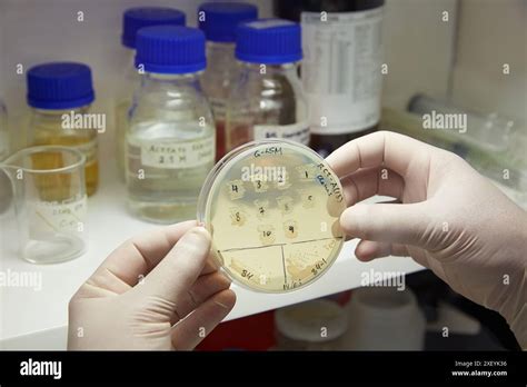 Anaerobic Cabinet Growth Of Anaerobic Bacteria In The Absence Of