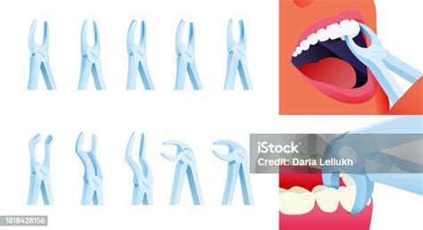 치과 추출 집게 세트 잘린 아름 다운 여성 얼굴 흰 치아 추출 집게 클로즈업 세트 현대 평면 벡터 일러스트 레이 션입니다 각도에 대한 스톡 벡터 아트 및 기타 이미지