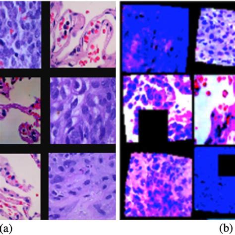 Comparison Of Original Images And Augmented Images Download Scientific Diagram