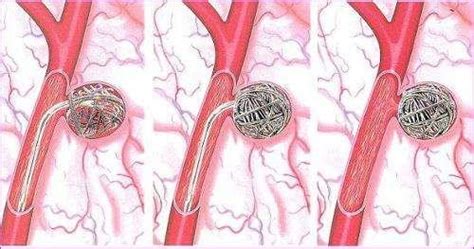 普外科图片 39医疗图集 39健康网