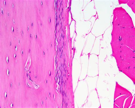 File Bone Histology Embryology