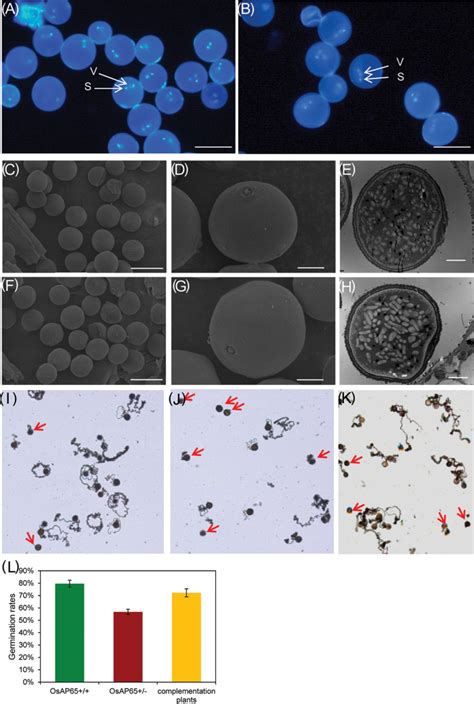 Morphology Of Pollen Grains Dapi Staining Of Pollen Grains From Download Scientific Diagram