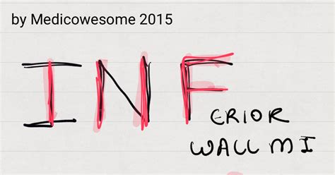 Medicowesome Zones Of Mi Leads And Ecg Mnemonic