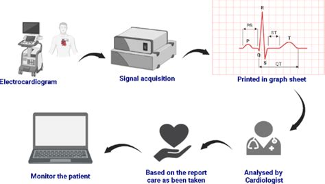 Conventional Method Of Detecting Heart Diseases From Electrocardiogram Download Scientific