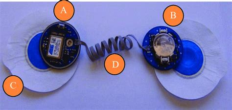 Wearable Wireless Ecg Sensor A Microcontroller And Radio Link B