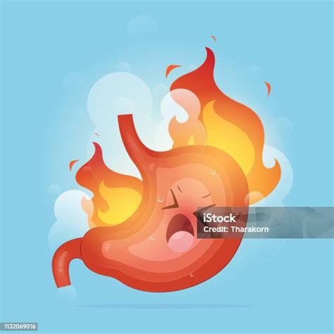 산 성 퇴조 또는 가슴 앓이 및 위 염 파란색 배경에서 그림 소화 불량 및 복 부 통증 문제 개념 만화 및 벡터 위에 대한 스톡