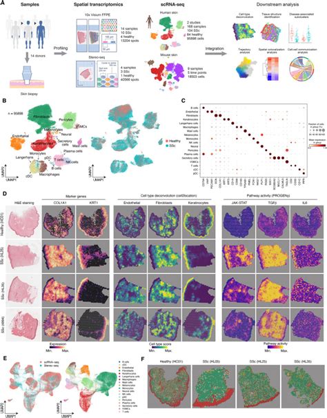 Spatial Multiomics Decipher Fibroblastmacrophage Dynamics In Systemic
