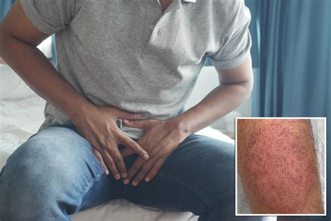 New Contagious Fungal Infection Found In Nyc After Patient Reported