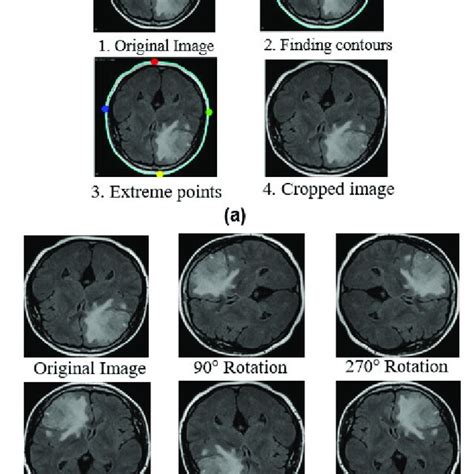 Data Preprocessing And Augmentation Results Figure5a Shows The