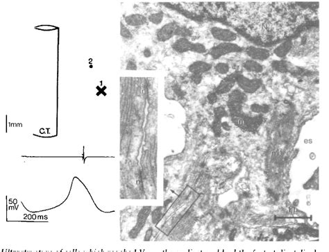 Structure Of Crista Terminalis Cordis Semantic Scholar