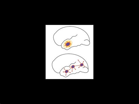 Journals And Publications Neurological Surgery