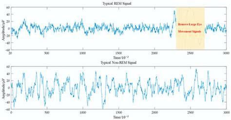 An Effective And Interpretable Sleep Stage Classification Approach