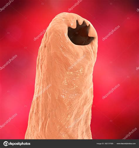 Head Parasitic Hookworm Ancylosoma Illustration Ancylostoma Duodenale
