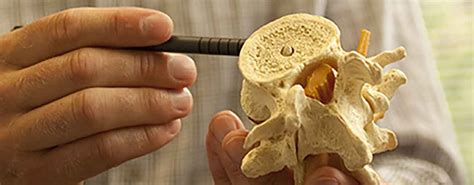 Chiropractic Maintenance Care Vs Mds Wellness Care