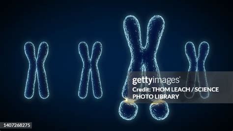 Fragile X Chromosome Illustration ストックイラストレーション Getty Images