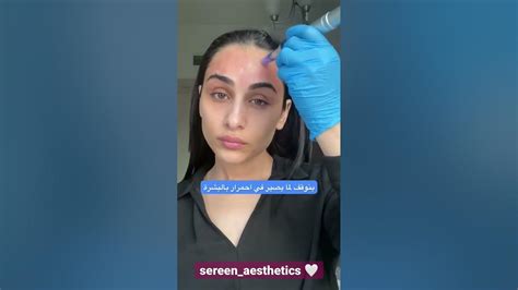 طريقة استخدام الديرمابن بالبيت Youtube