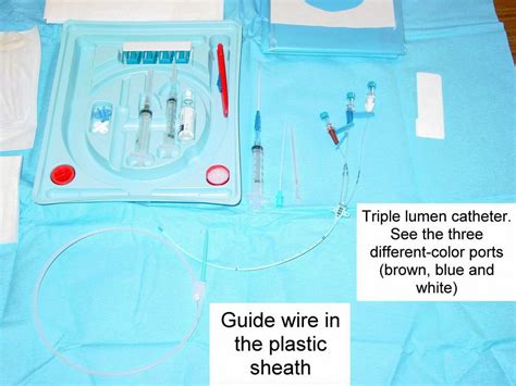 Clinical Notes Central Line Placement A Step By Step Procedure Guide With Photos