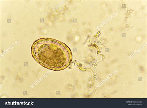 Egg Ascaris Lumbricoides Roundworm Stool Analyze Foto Stock 1030206205