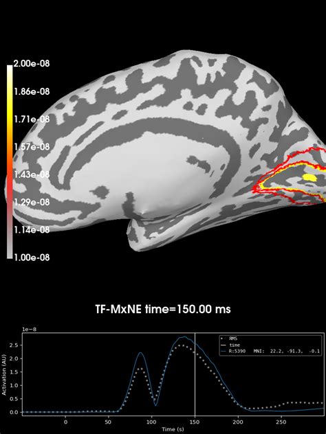 Compute Mxne With Time Frequency Sparse Prior — Mne 1101 Documentation