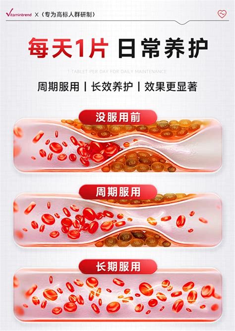 Vitamintrend德国原装进口纳豆激酶软化疏通心脑血管堵塞清道夫 脑梗血栓优清理血管垃圾的药 1瓶装【图片 价格 品牌 报价】 京东 花瓣网