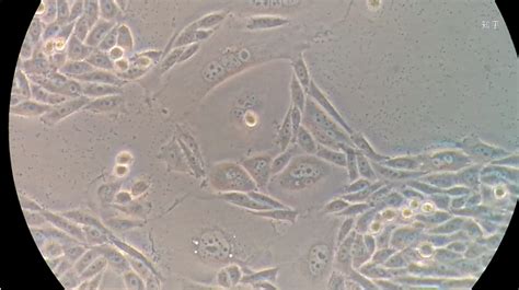 细胞培养常见污染图片与鉴别 知乎