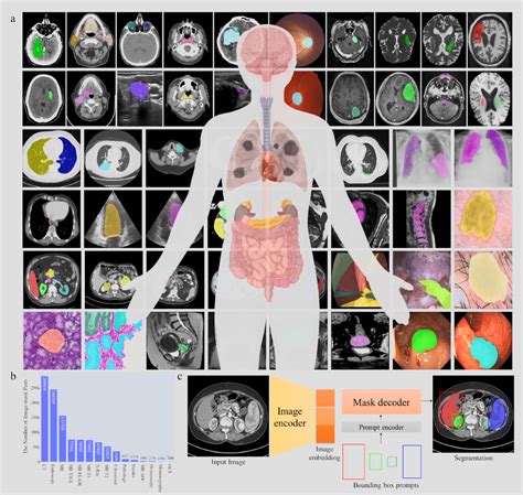 Segment Anything In Medical Images One Last Kiss