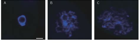 Figure 1 From Effect Of Oocyte Chromatin Status In Porcine Follicles On