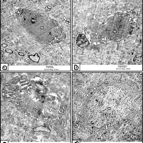 Electron Micrographs Of The Cerebral Cortex Of Control Rat Ab A