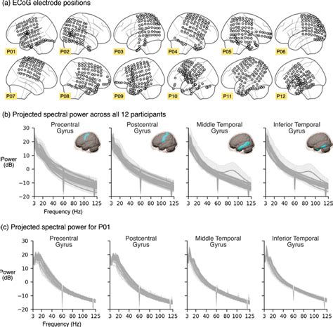 Validation Of Intracranial Neural Signal Quality A Download Scientific Diagram