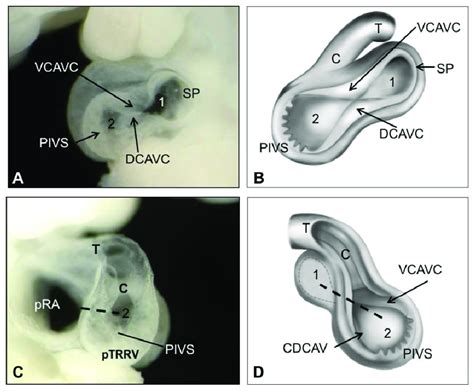 Onset Of Cardiac Septation In A Rat Embryo Of An Age Equivalent To