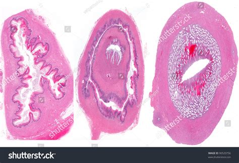 Transverse Cross Sectional View Female Reproductive Photo De Stock