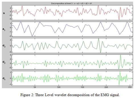 Emg Signal Analysis For Diagnosis Of Muscular Dystrophy Using Wavelet Transform Svm And Ann